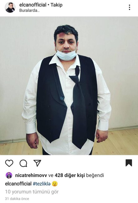 Elcan döyülüb?- FOTO